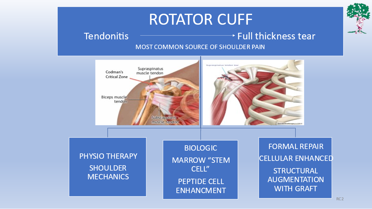 Shoulder Care - Dr. Steven T. Plomaritis, DO