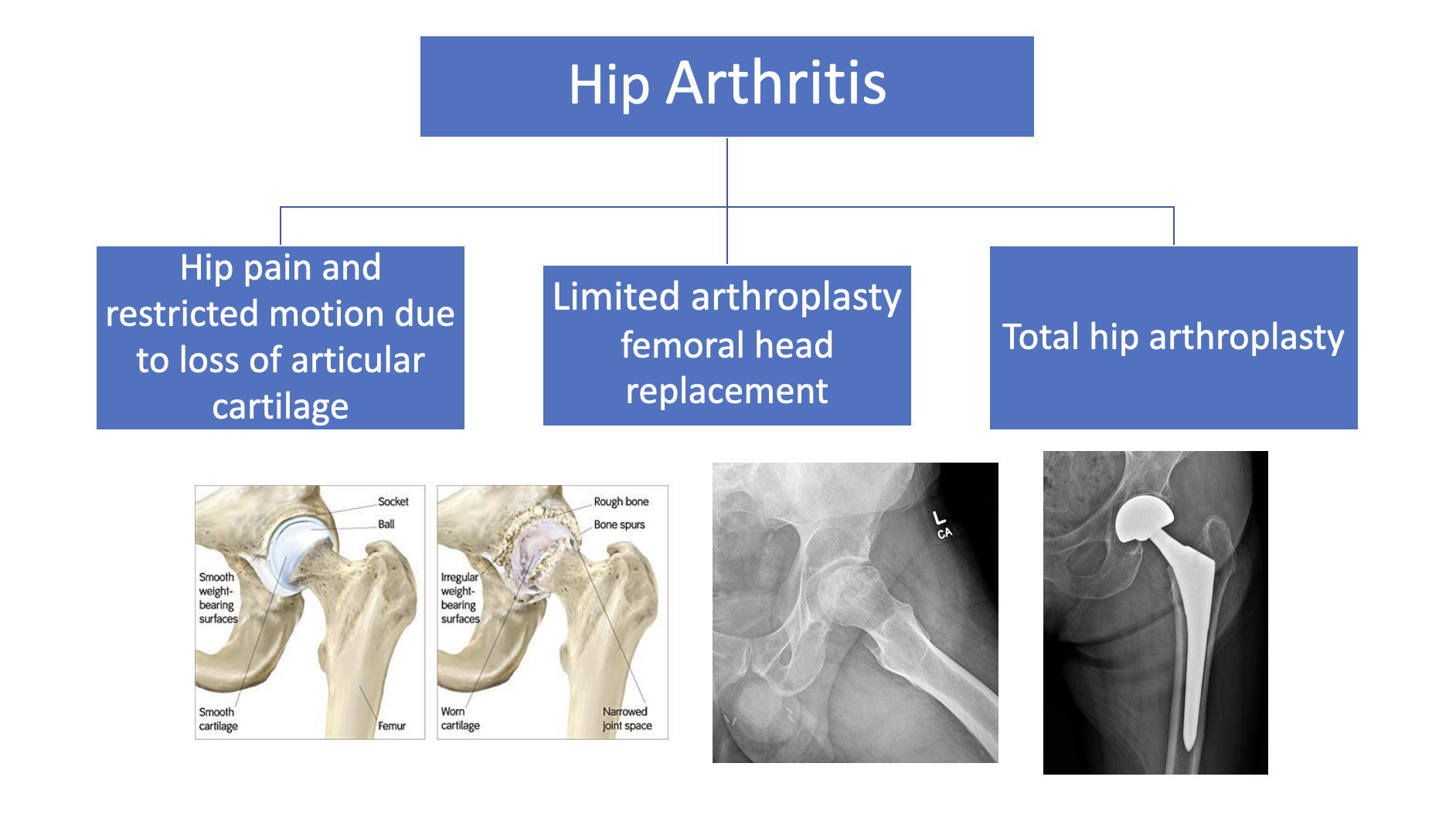 Hip Care - Dr. Steven T. Plomaritis, DO